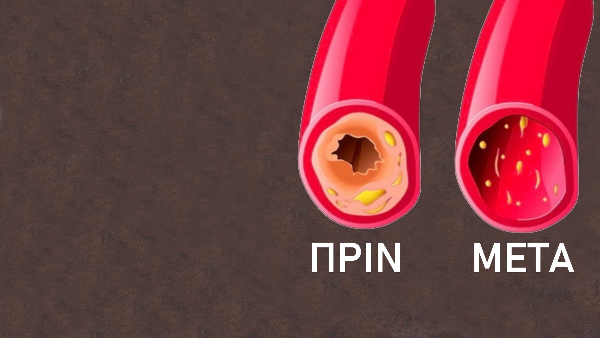Πως Να Διατηρήσετε Τα Αγγεία Σας Καθαρά; - Ακαδημία Υγείας